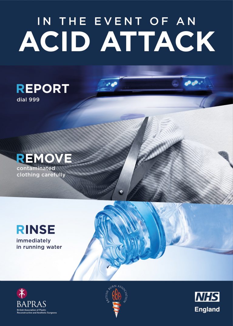 NHS Guidance on Acid Attacks – Adult Burn Support UK