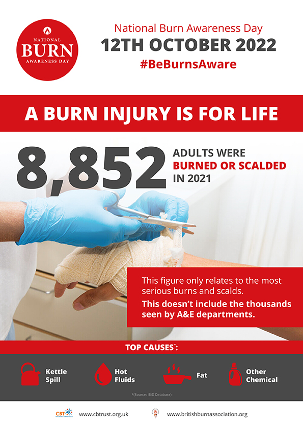 National Burn Awareness Day – Adult Burn Support UK