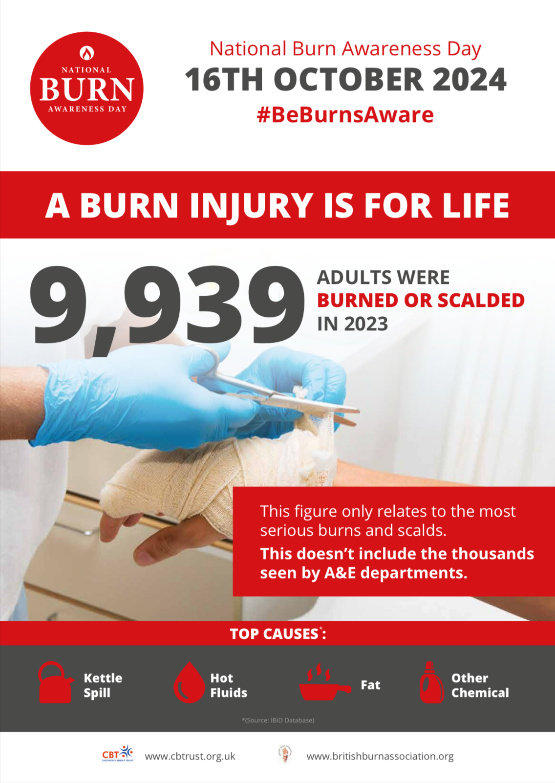 National Burn Awareness Day – 16 October 2024 – Adult Burn Support UK