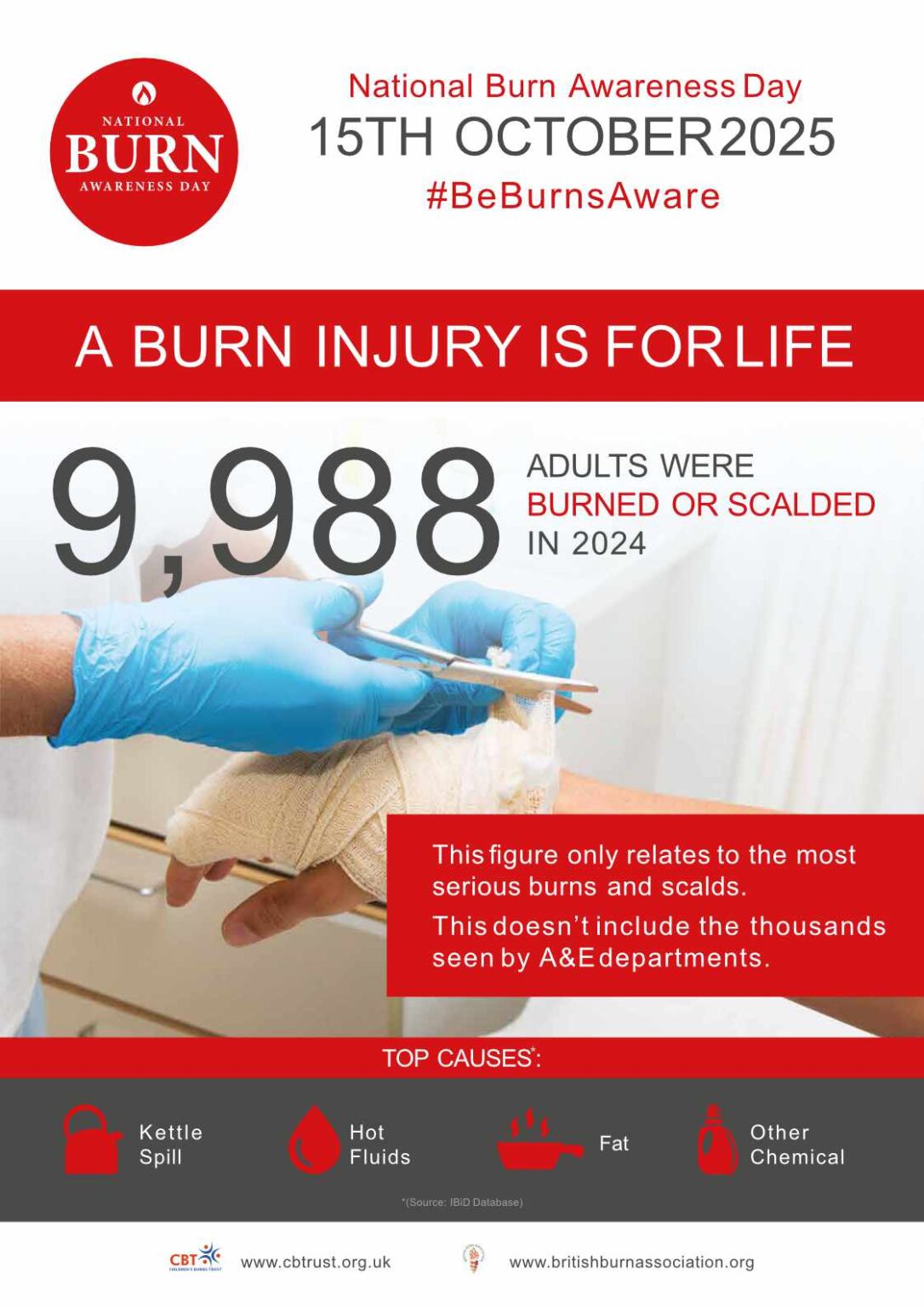National Burn Awareness Day – 15 October 2025 – Adult Burn Support UK